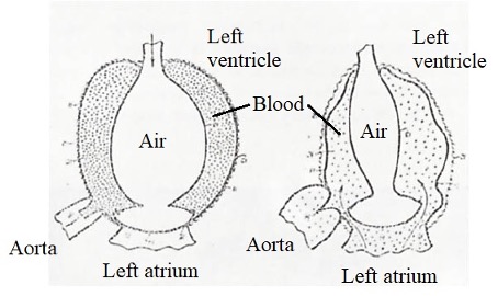 Terumo Artificial Heart Collection | Artificial Organs