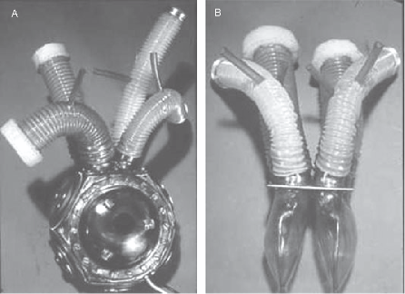 Terumo Artificial Heart Collection | Artificial Organs